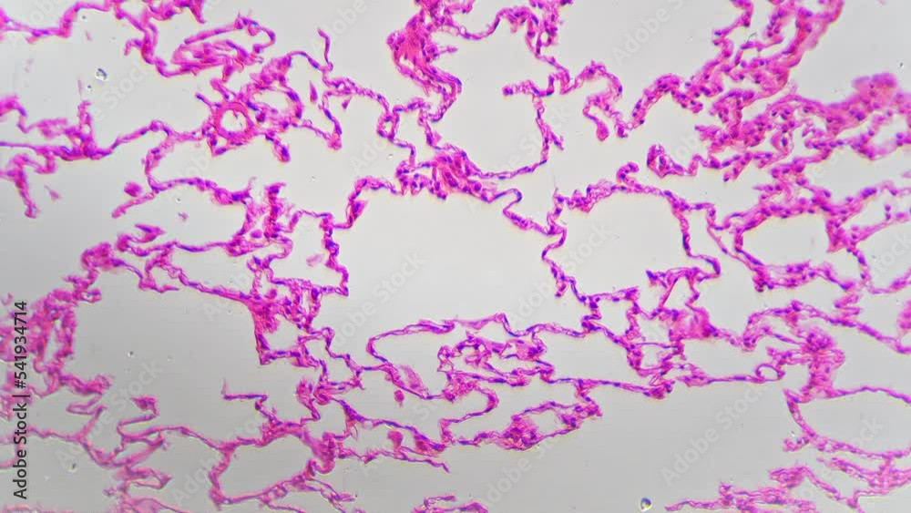 Section of lung tissues with cells under microscope magnified in 200 ...