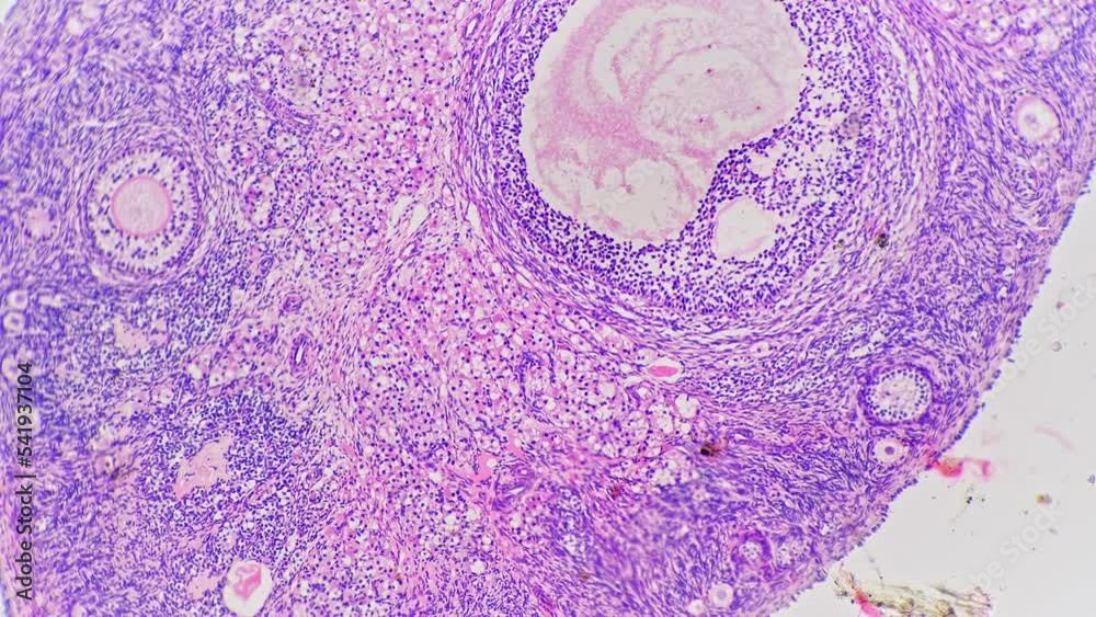 Ovary in section magnified under light micrograph 40x against bright ...