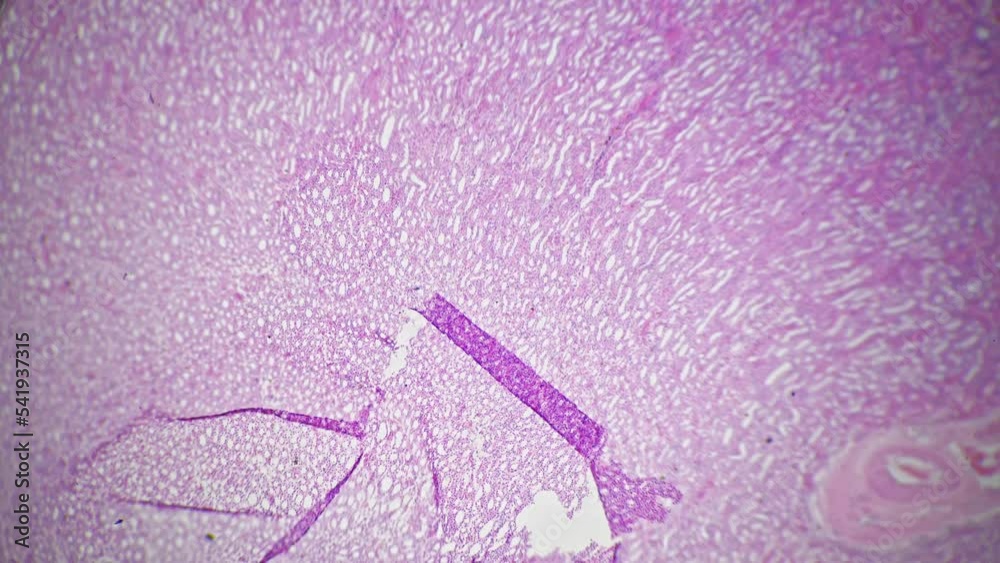 Artery and vein in section magnified under microscope in 40 times ...
