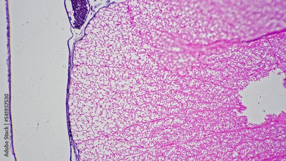 Microscopic sample Spinal cord cell TS 200x magnification tinted pink. Scientist finding illness ...