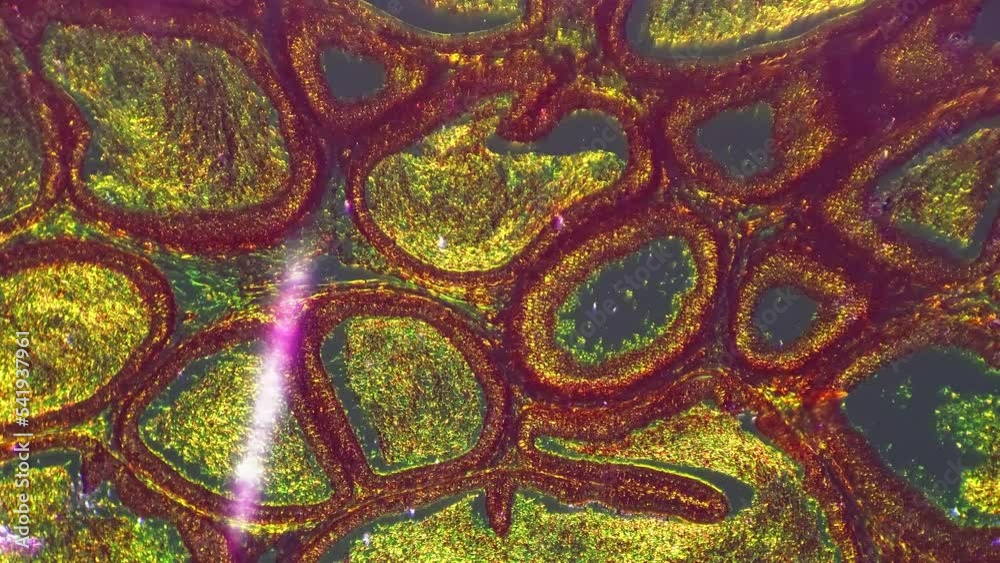 Microscopic slide with testis in transversal section magnified in 100 ...