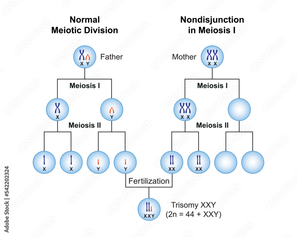 Scientific Designing of Nondisjunction in Trisomy XXY (Klinefelter ... Scientific Designing of Nondisjunction in Trisomy XXY (Klinefelter ...