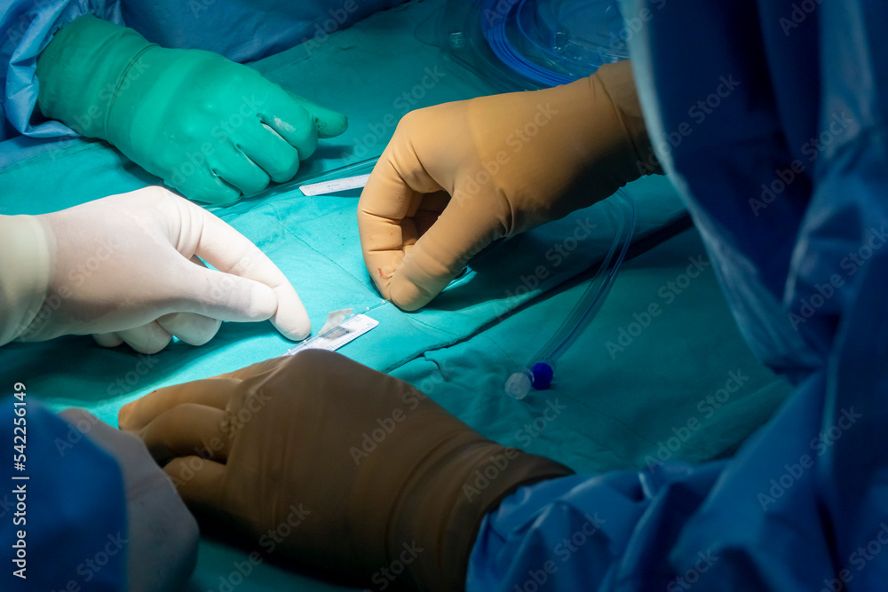 Step by step Visualase is an MRI-guided laser ablation system used to ... Step by step Visualase is an MRI-guided laser ablation system used to ...