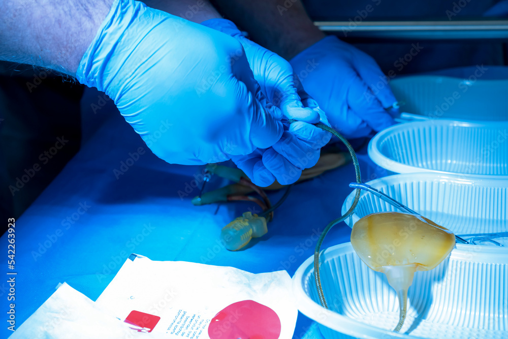 Penis Penile Implant Penis Enlargement Surgery Balloon Insertion Inflation Penile Prosthesis