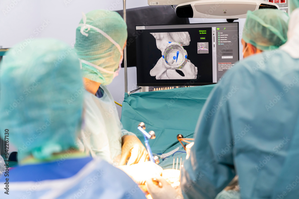 Team of doctor perform total hip arthroplasty replacement surgery in ...