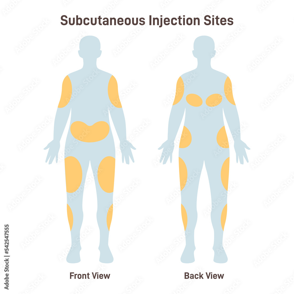 Subcutaneous injection sites. Medicine injection sites on the human ...