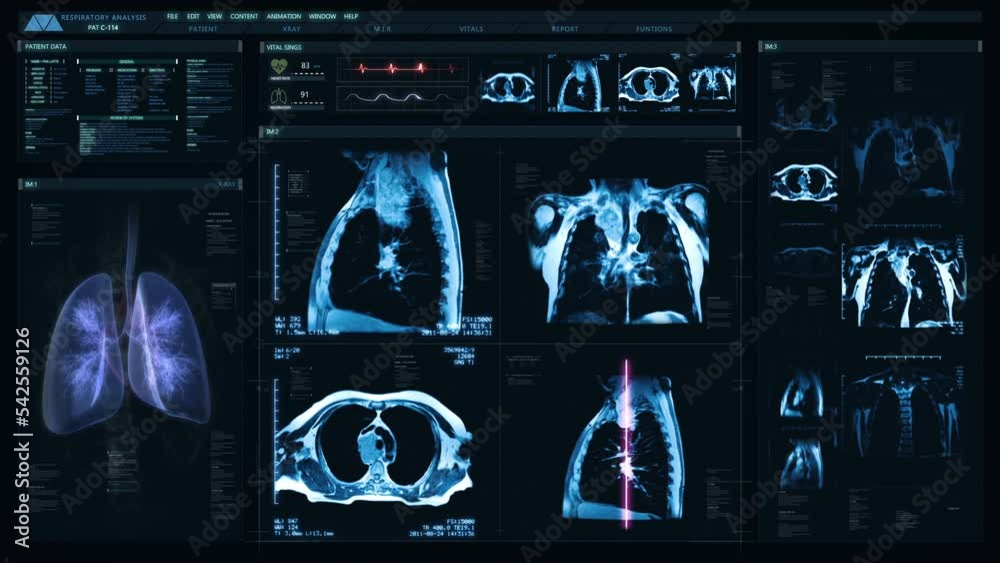 Futuristic Technological Interface Analyzing Human Anatomy. Medical ...