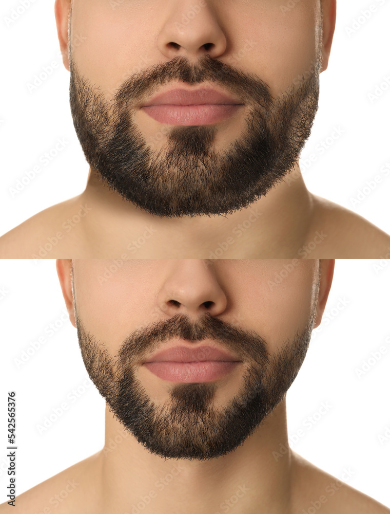 Double chin problem. Collage with photos of man before and after ...