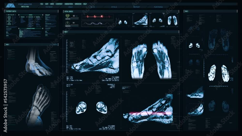 Futuristic Technological Interface Analyzing Human Anatomy. Medical ...