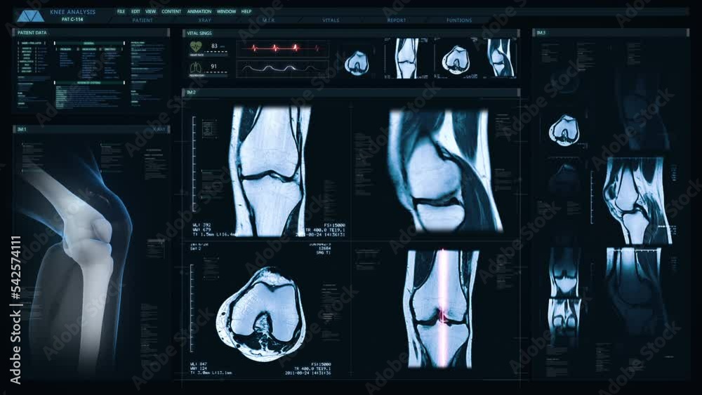 Medical Profile of Patient Showing Knee MRI Scan, 3D Joint Region And ...