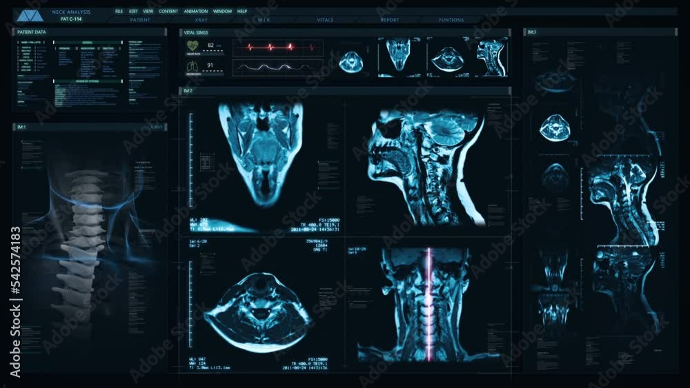 Futuristic Technological Interface Analyzing Human Anatomy. Medical ...