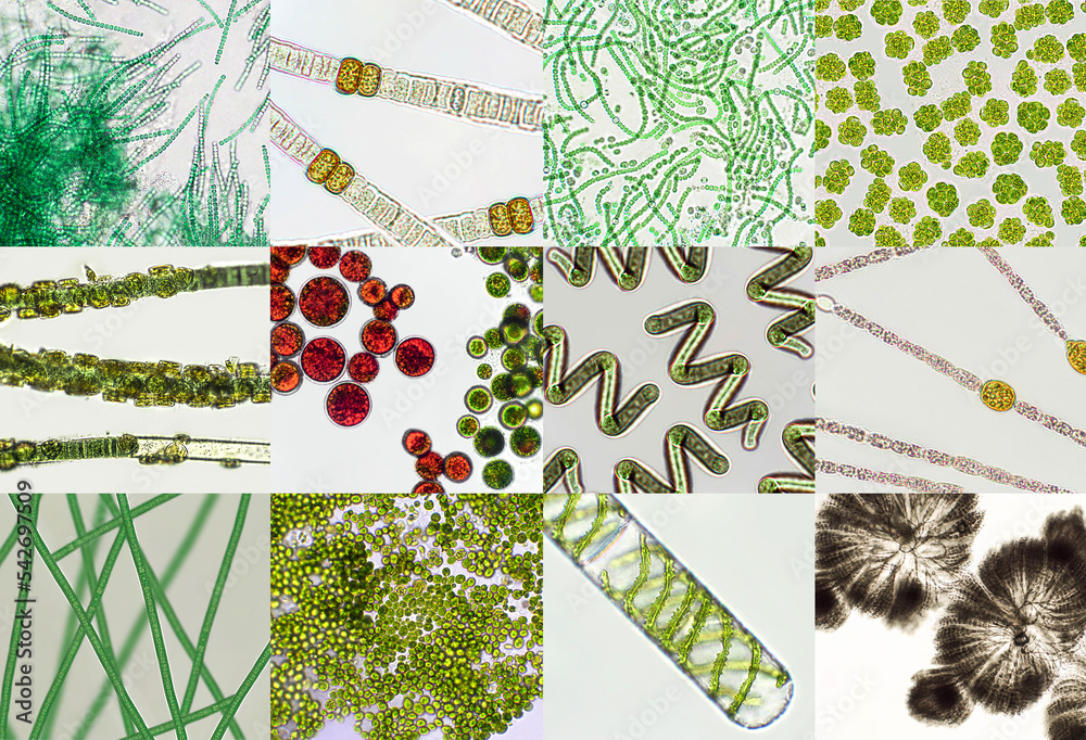 Microalgae under microscopic view, green algae, cyanobacteria ...