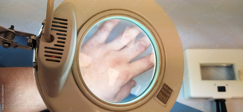hand image inside magnifying glass used in dermatology Stock Photo ...
