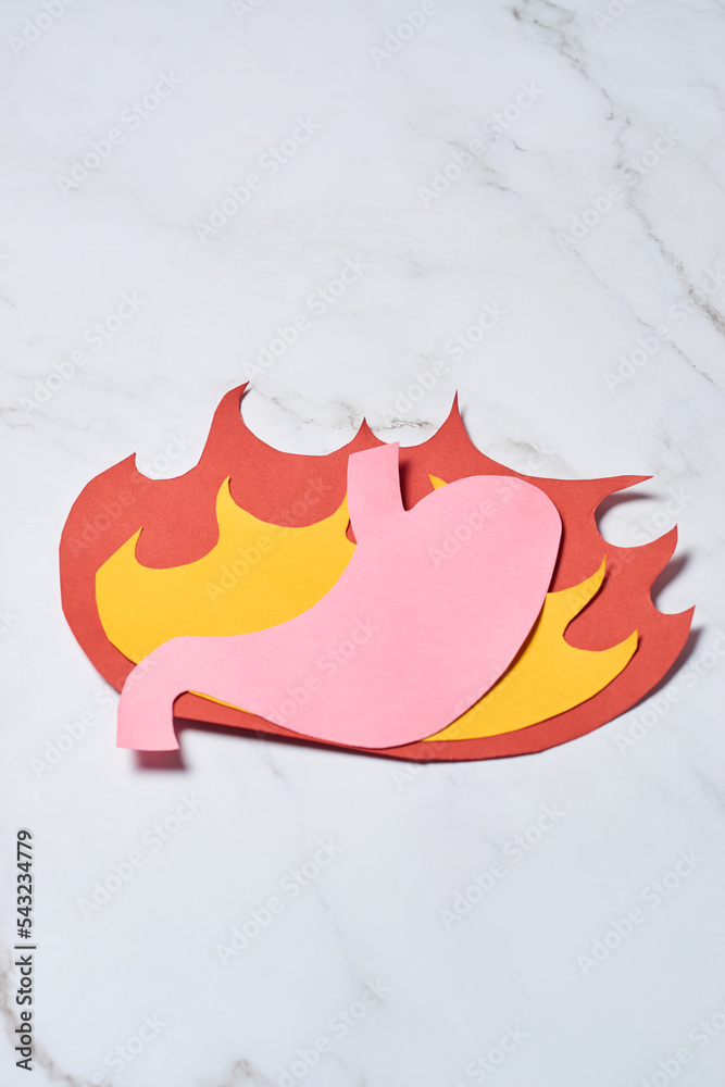 Stomach on fire. Concept of gastritis and stomach ulcers. Stock Photo ...