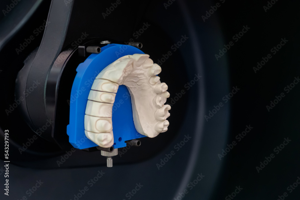 Automatic 3D dental scanner for dental gypsum model scanning and ...