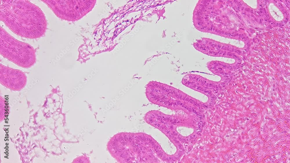 Transversal section of testis shown under microscope and magnified in ...