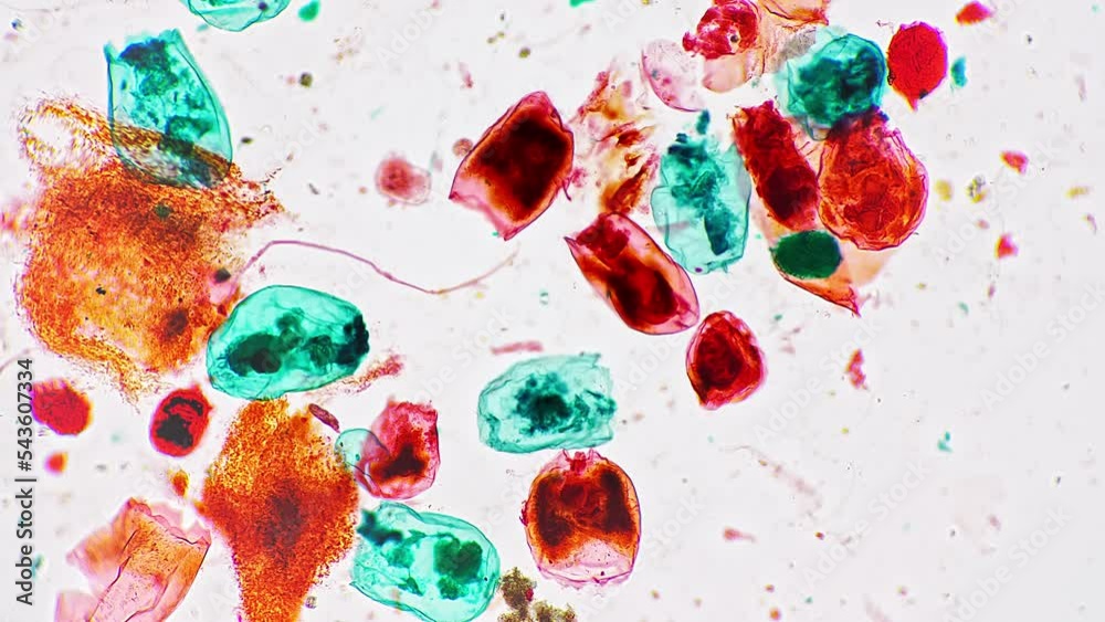 Macro footage of rotifera whole mount under laboratory microscope 100x ...