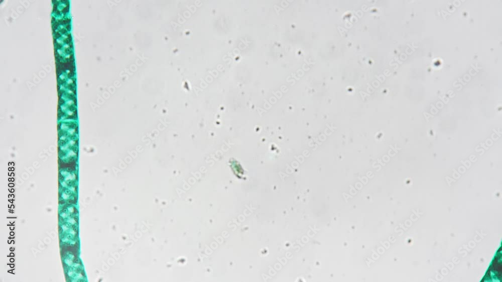 Video Stock Green alga spirogyra under microscope magnified in 400 ...