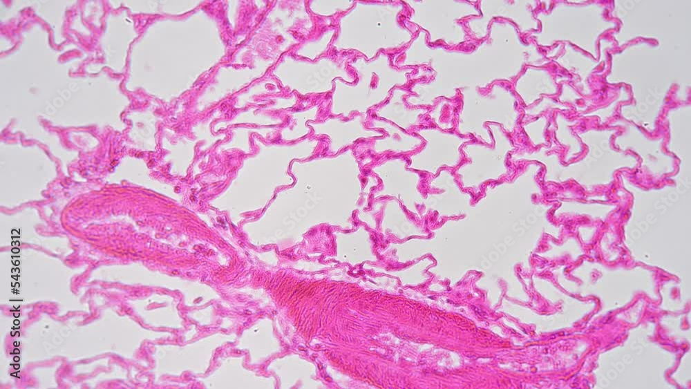 Section of lung tissues under microscope magnified in 200 times against ...