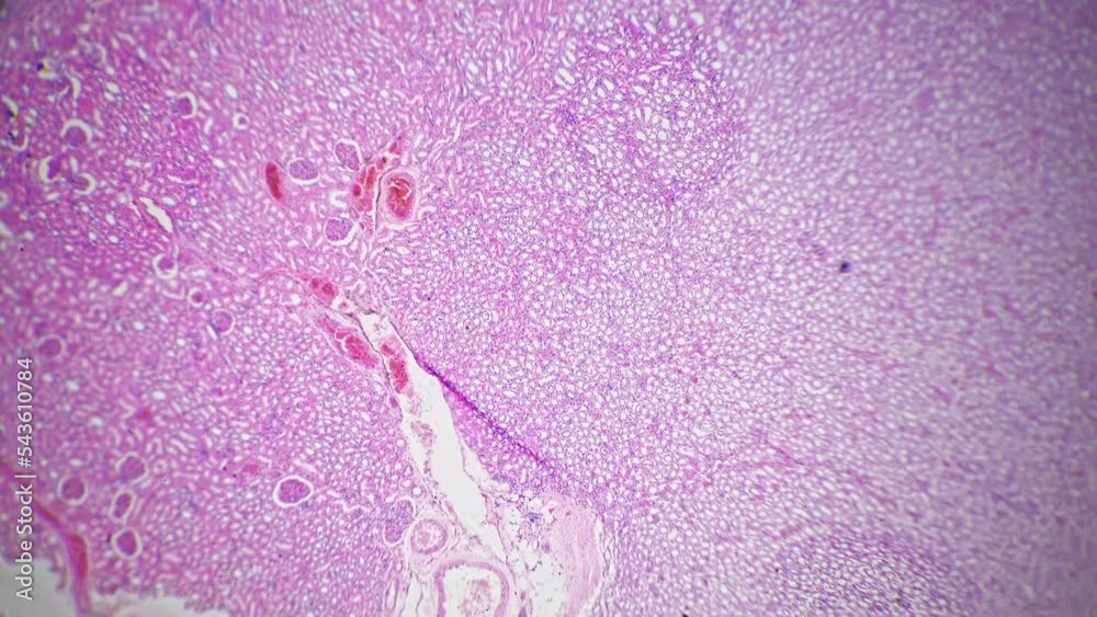 Artery and vein in section magnified under microscope 40x filmed on ...