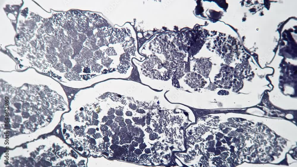 Meiosis of grasshopper in section under microscope magnified in 200 ...