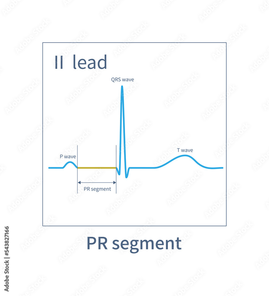 Pr Segment Is An Ecg Segment Located Between The End Point Of P Wave