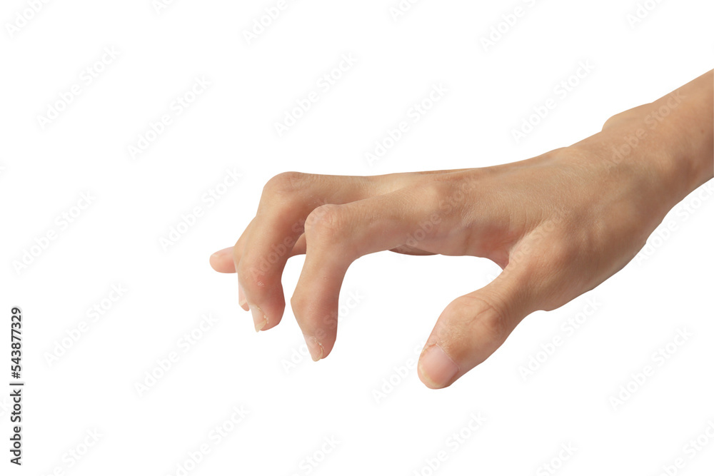 hand was bent due to a bone problem isolated on white background ...