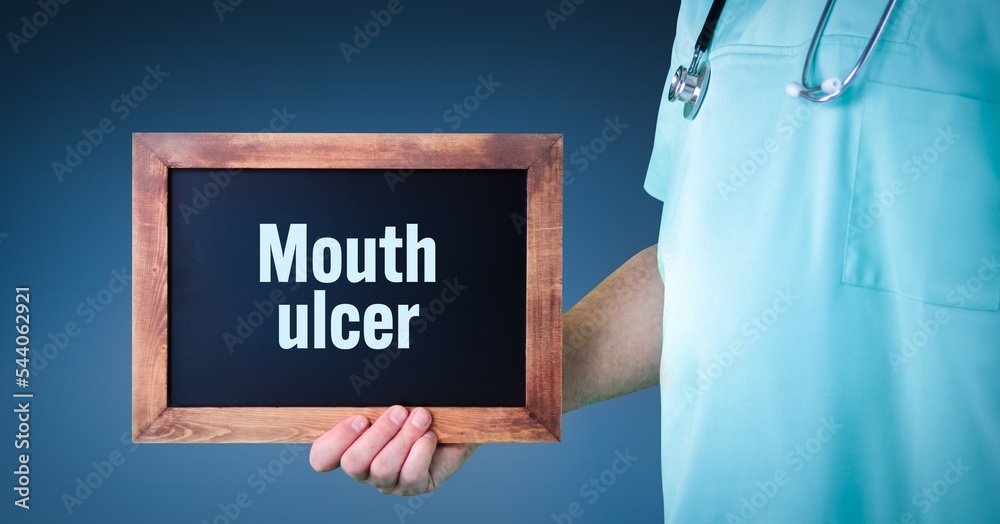 Mouth ulcer. Doctor shows sign/board with wooden frame. Background blue ...