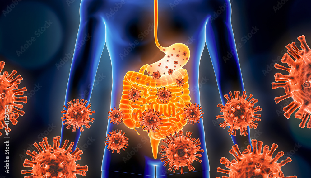 Gastroenteritis or stomach flu 3d rendering illustration with red virus cells and human body ...