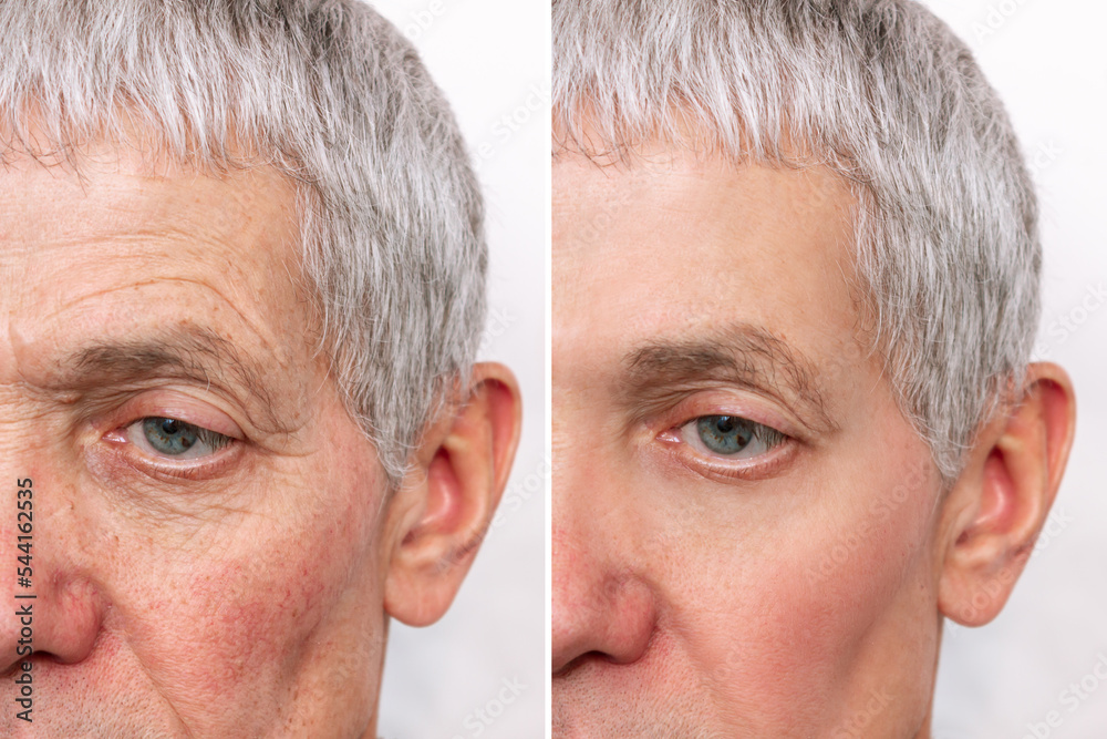 Cropped shot of an elderly caucasian gray-haired man's face with facial ...