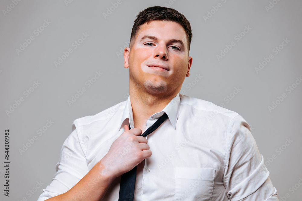 Studio portrait of a young guy male with symmetrical patches of ...