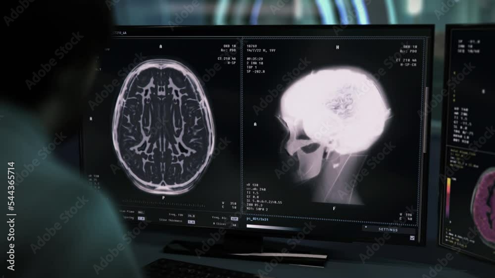 Video Stock Medical injury treatment analysis system examining the ...