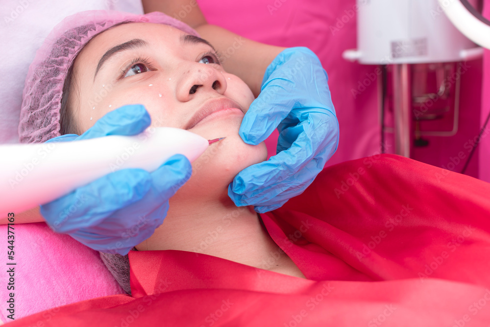 An esthetician uses a mini wireless cautery machine to remove warts ...