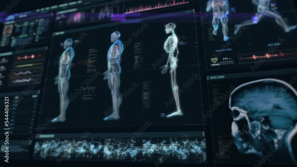 Futuristic HUD Interface Showing Anatomy Of Human Body. Patient ...