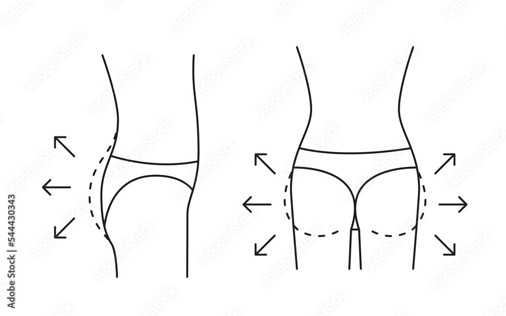 Buttock increase of woman, shape butt with arrow and contour, line icon ...