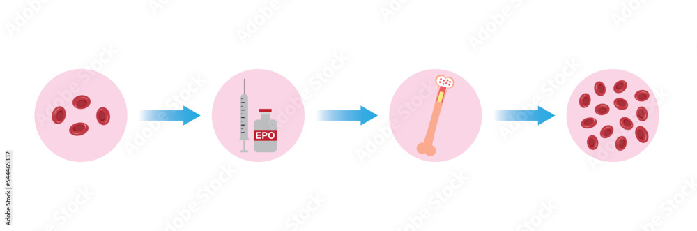 Scientific Designing of Erythropoietin (EPO) Effect on Bone After ...
