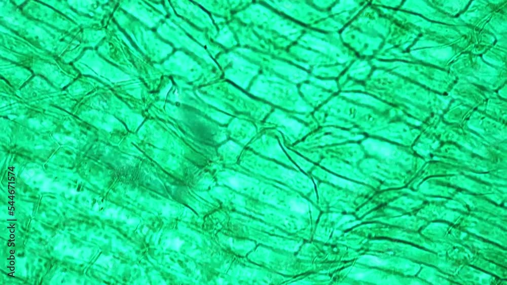 Leaf of hydrilla verticillata in longitudinal section under microscope ...