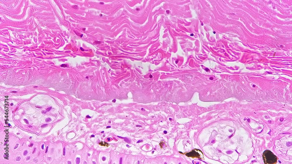 Human Epidermal Cells 100x General Biology Lab Loyola Nervous Tissue ...