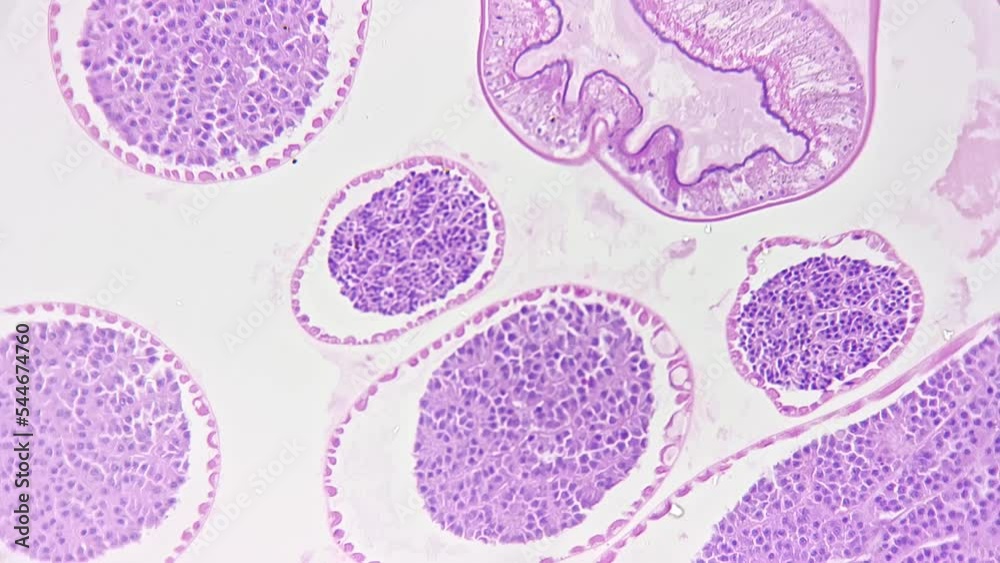 Cross section of ascaris magnified under microscope in 400x filmed on ...