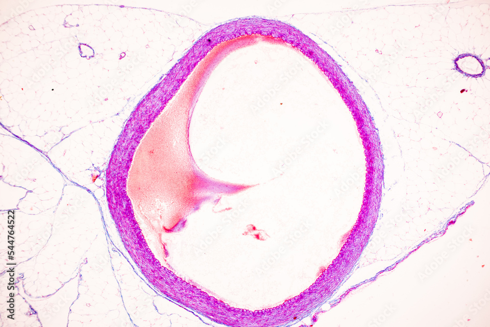 Tissue of Blood human, Vein human, Artery human and Heart muscle human ...