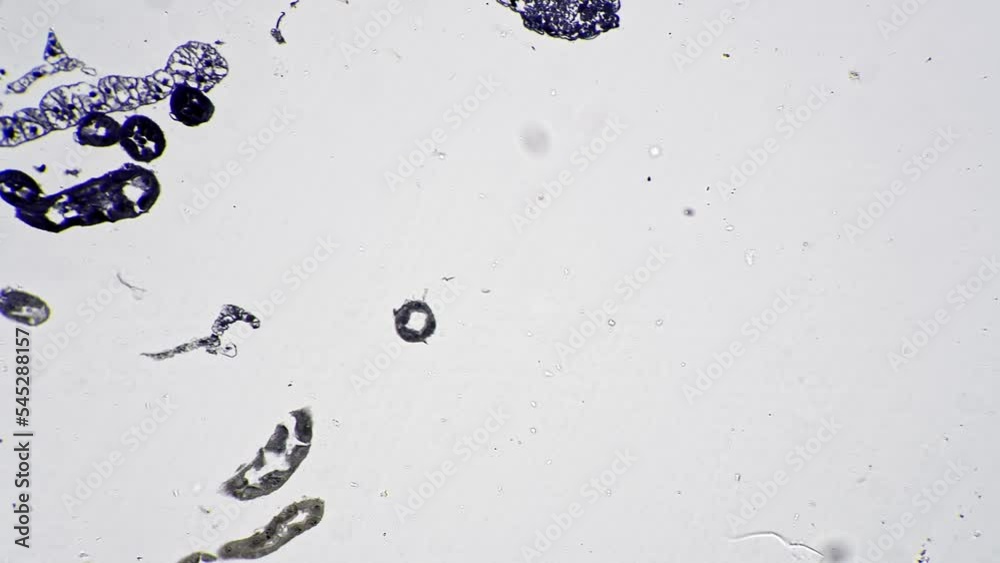 Meiosis of grasshopper in section under microscope magnified in 100 ...