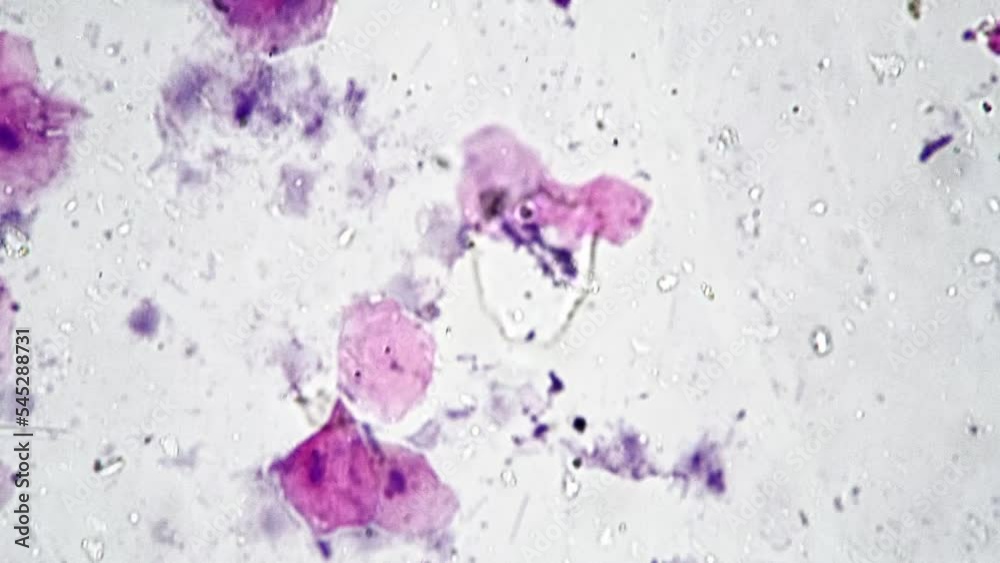 Epithelium cells of cavitas oris of human whole mount under microscope ...