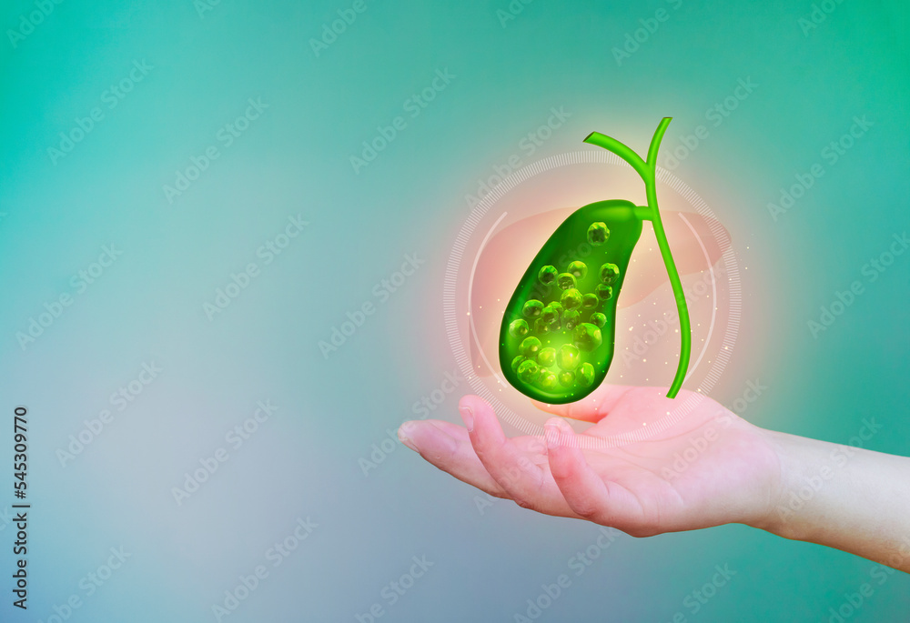 Gallbladder with stone. Care and treatment gallstones, cholecystitis ...