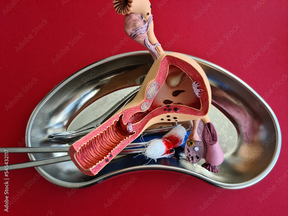Surgery of genital organs of the uterus and ovaries in women Stock ...