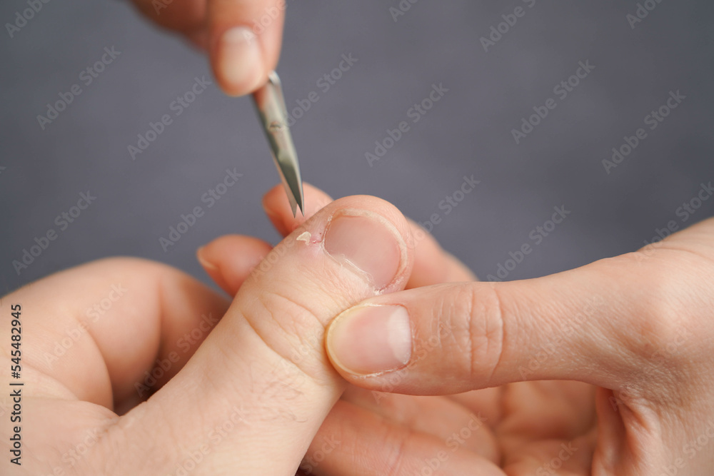 Men's manicure at home. Cut fingernails. Fingernails close-up ...