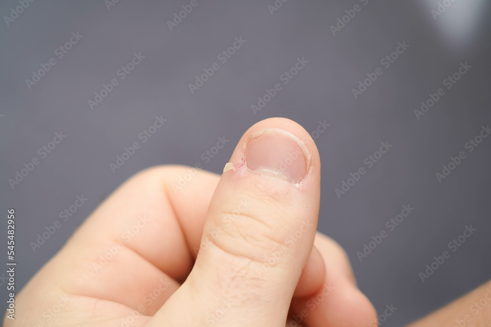 Foto de Men's manicure at home. Cut fingernails. Fingernails close-up ...