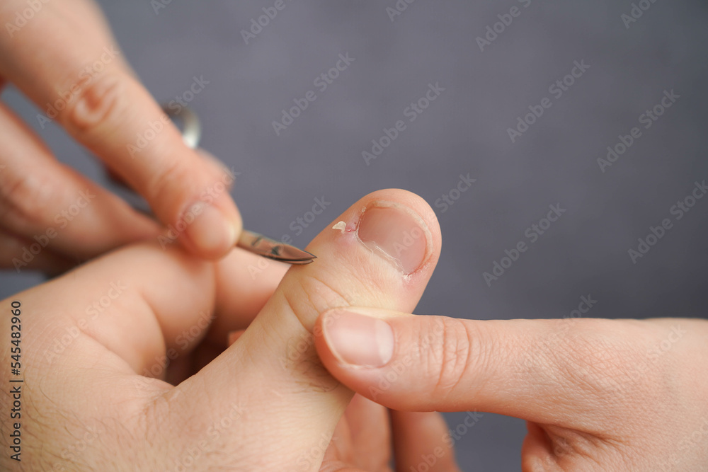 Men's manicure at home. Cut fingernails. Fingernails close-up ...