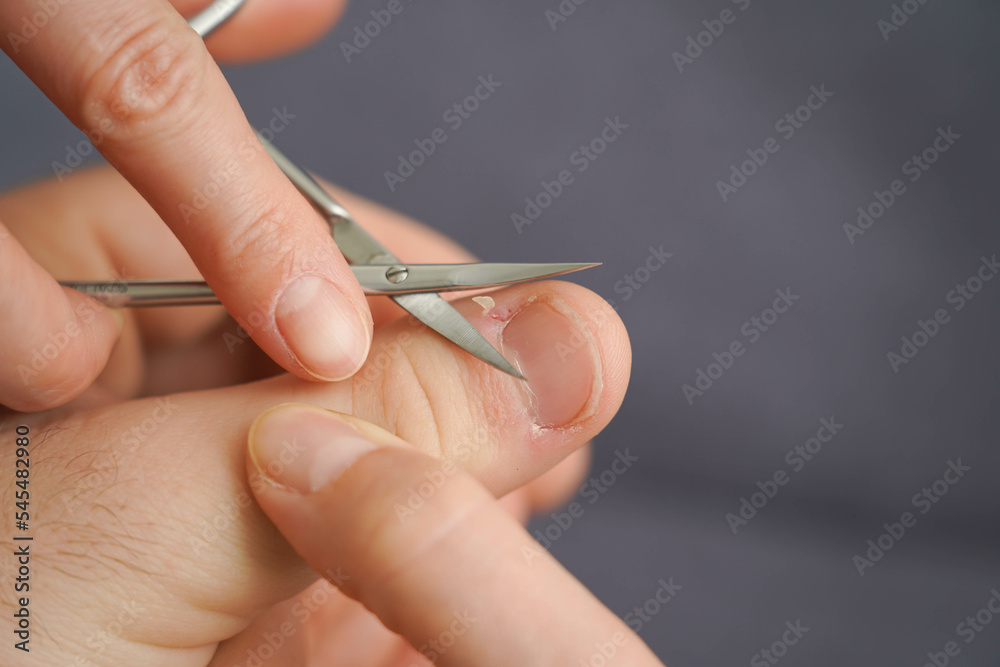 Men's manicure at home. Cut fingernails. Fingernails close-up ...