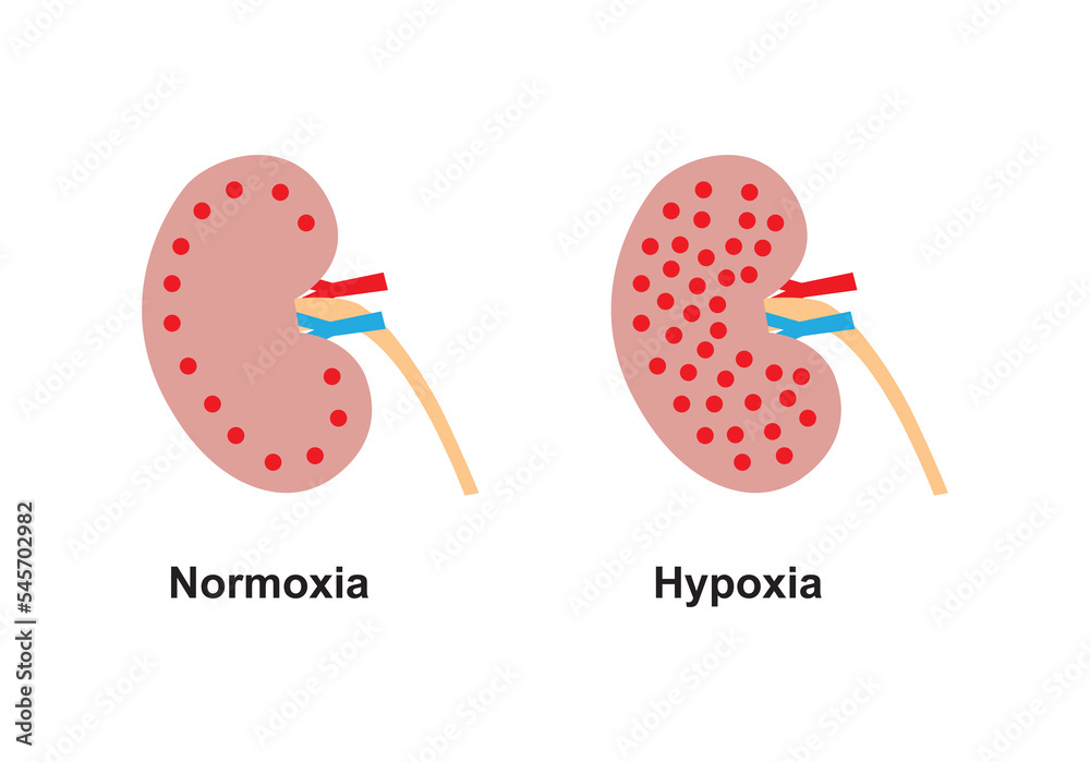 Scientific Designing of Comparison Between Normoxia and Hypoxia ...