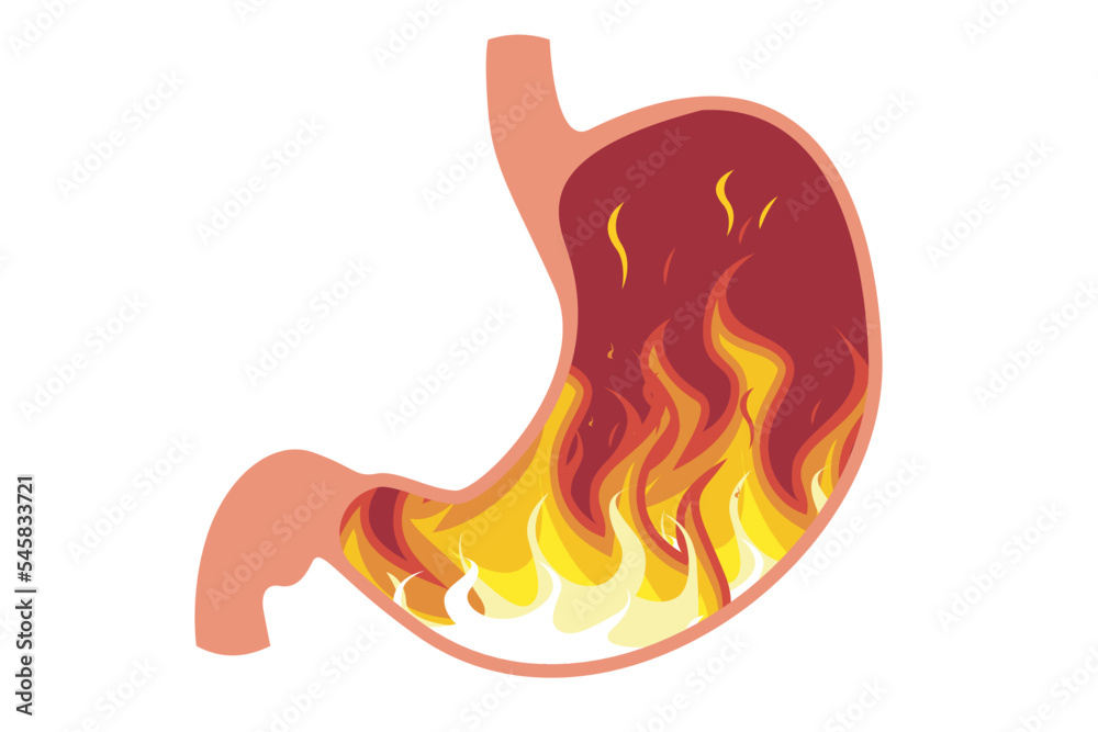 Stomach ache vector. Diseases of the human stomach. Human stomach ...